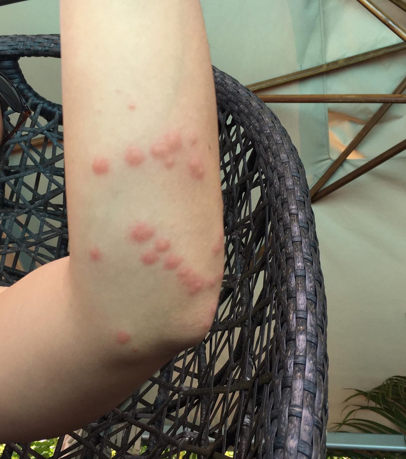 Bettwanzen Bilder | Bettwanzenproblem